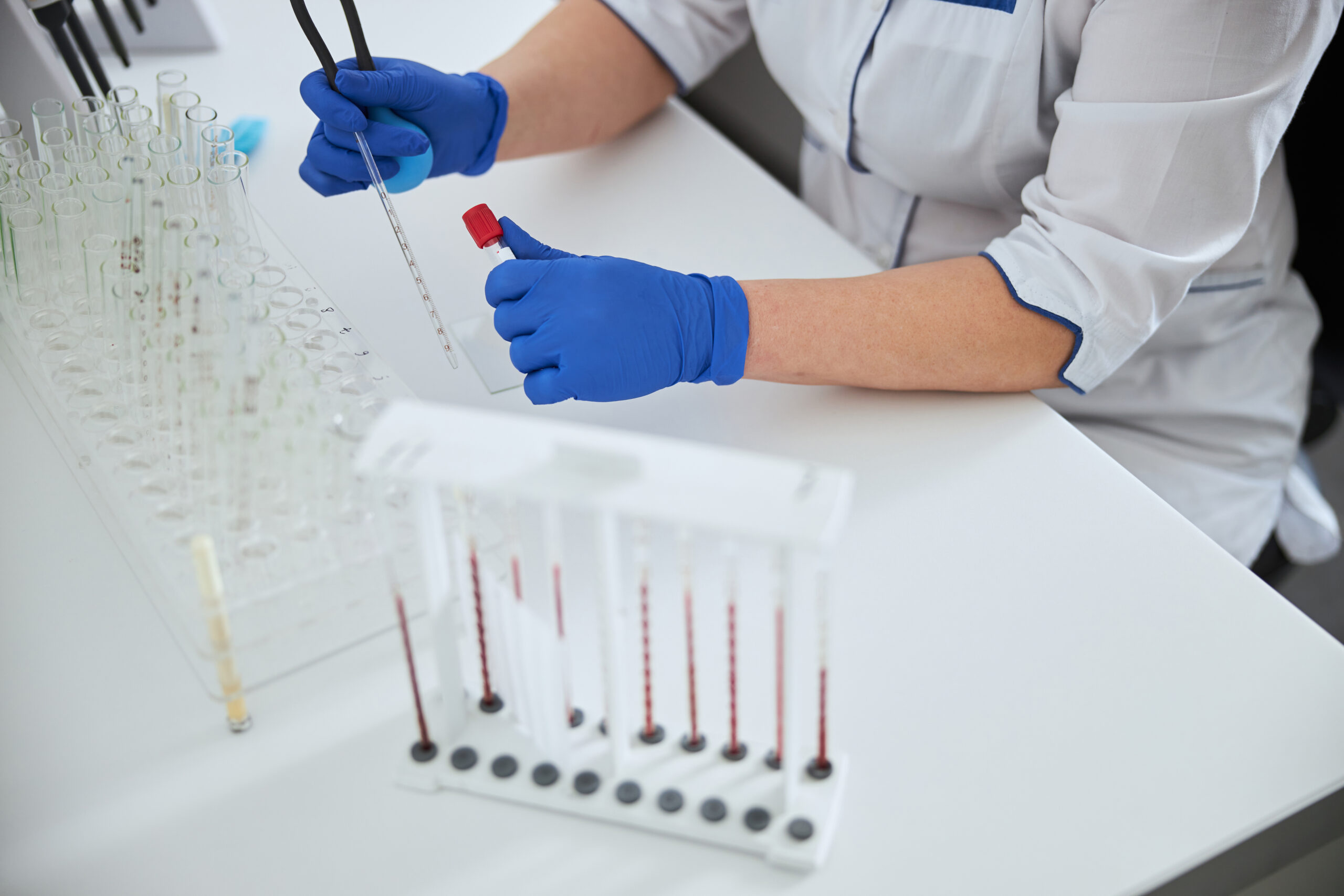 4 informazioni utili sul test sierologico